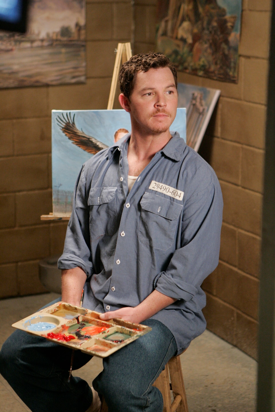 null: Burn Victim Photo: 784481 - NBC.com