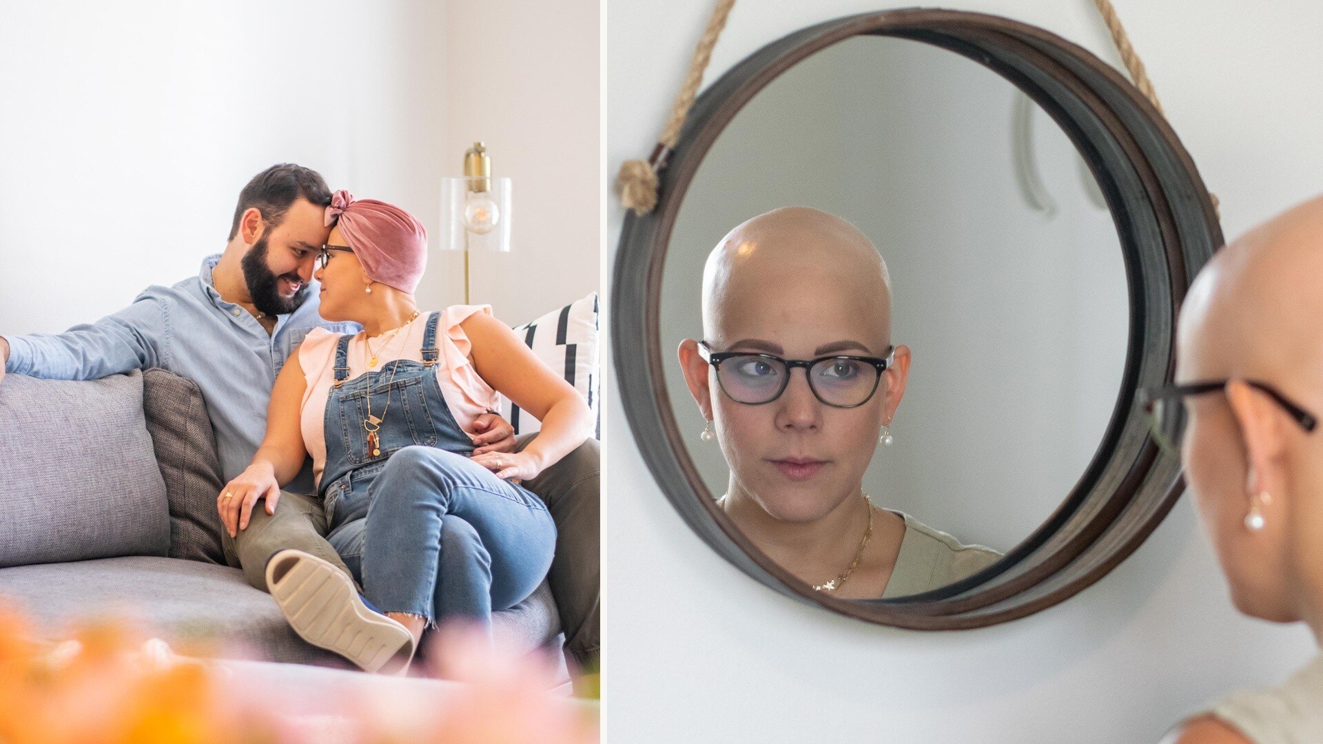 Watch Hoy Día Highlight: Sufrió rechazo por padecer alopecia desde los ...