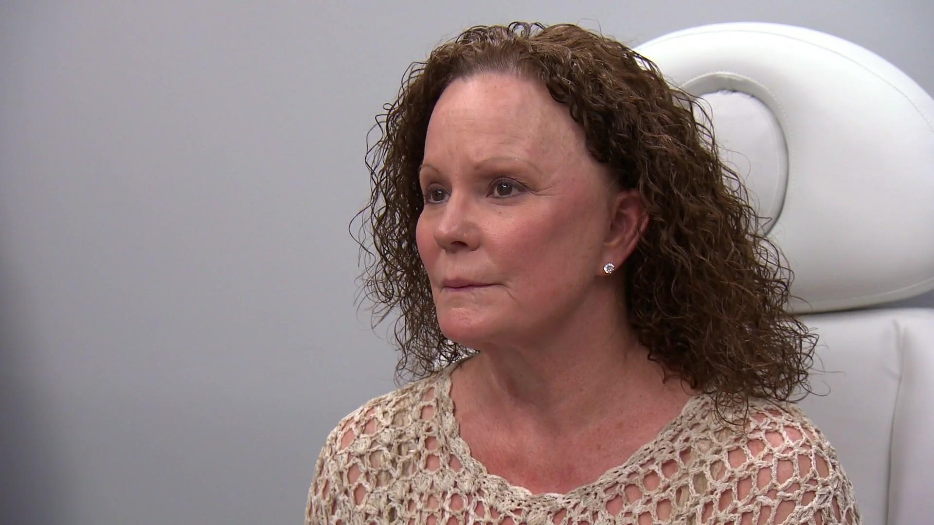 Watch Botched Episode: Cougars And Cobras and Boobs...Oh My! - NBC.com