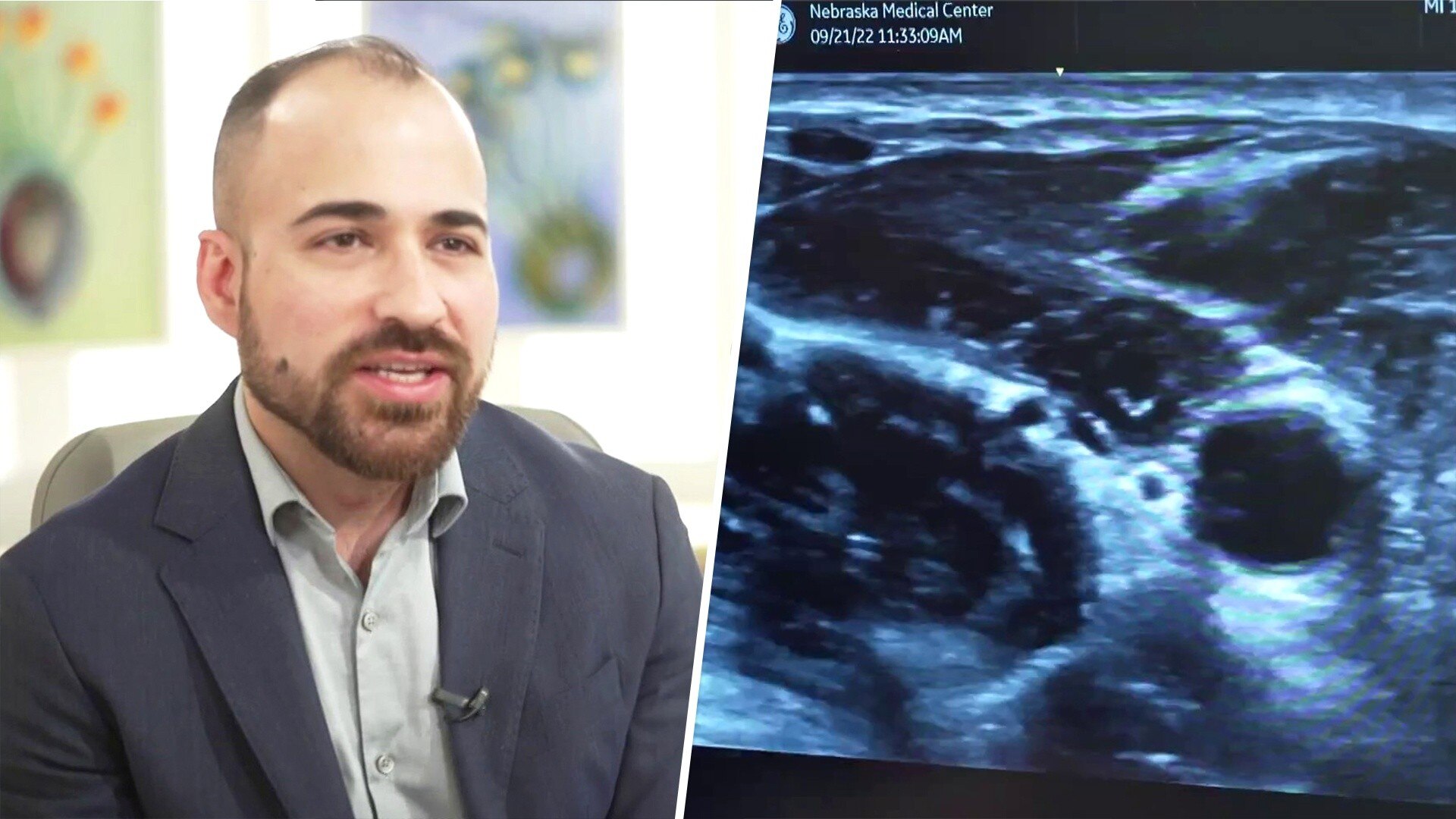 Watch TODAY Excerpt: Doctor finds cancer in his thyroid while testing ...