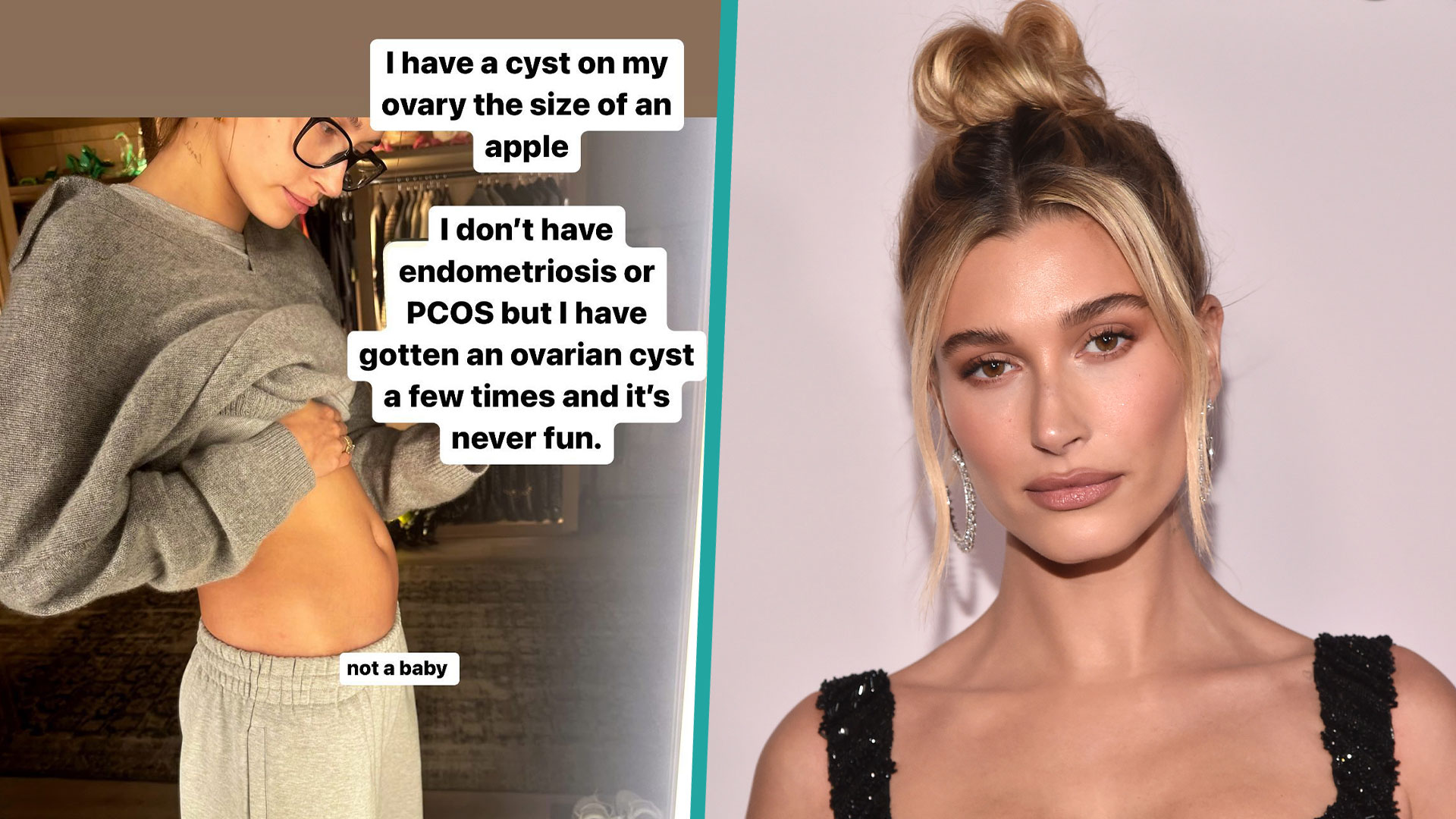 Watch Access Hollywood Highlight: Hailey Bieber Reveals She Has An Ovarian Cyst 'The Size Of An ...
