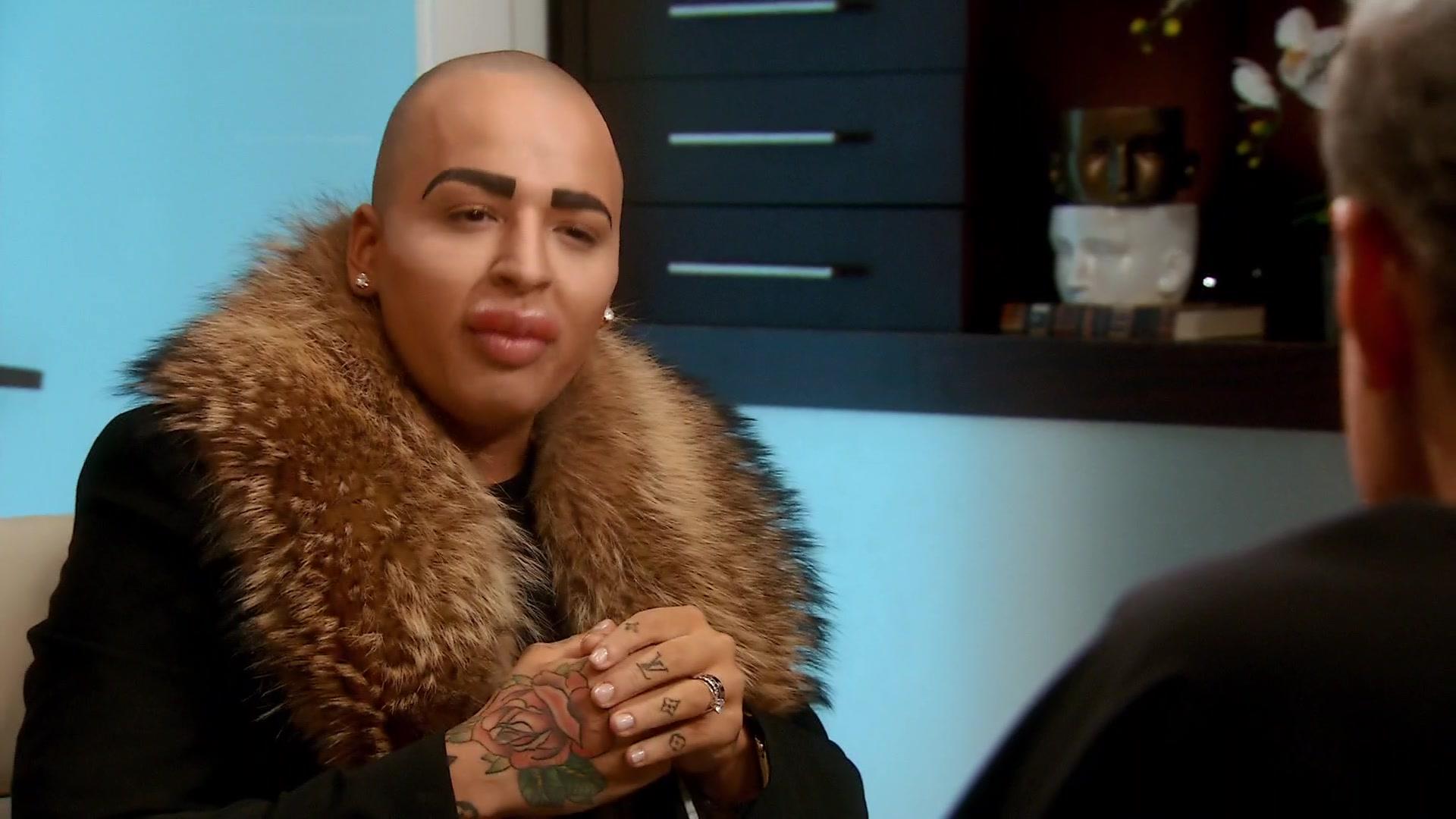 Watch Botched Episode: Mo' Steroids Mo' Problems - NBC.com