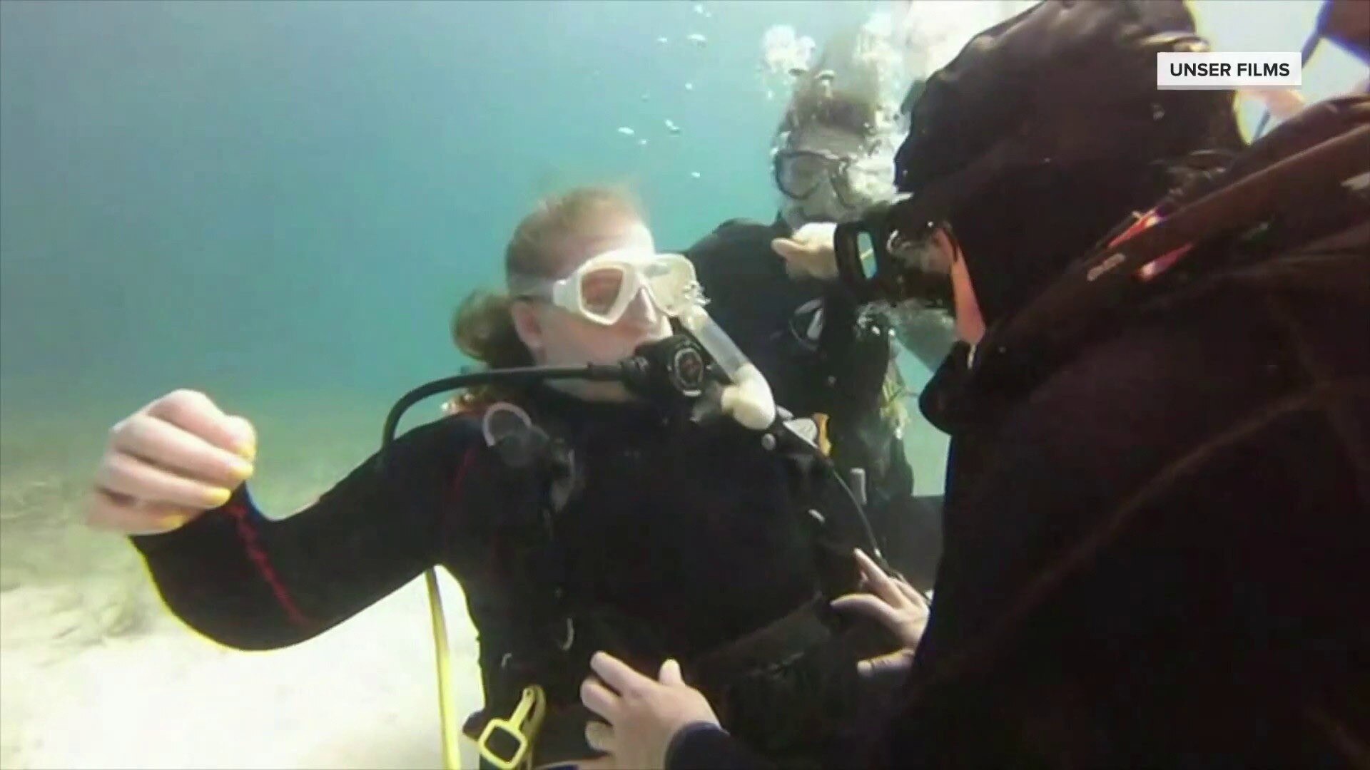 Watch TODAY Excerpt: Woman with rare disorder finds healing through ...