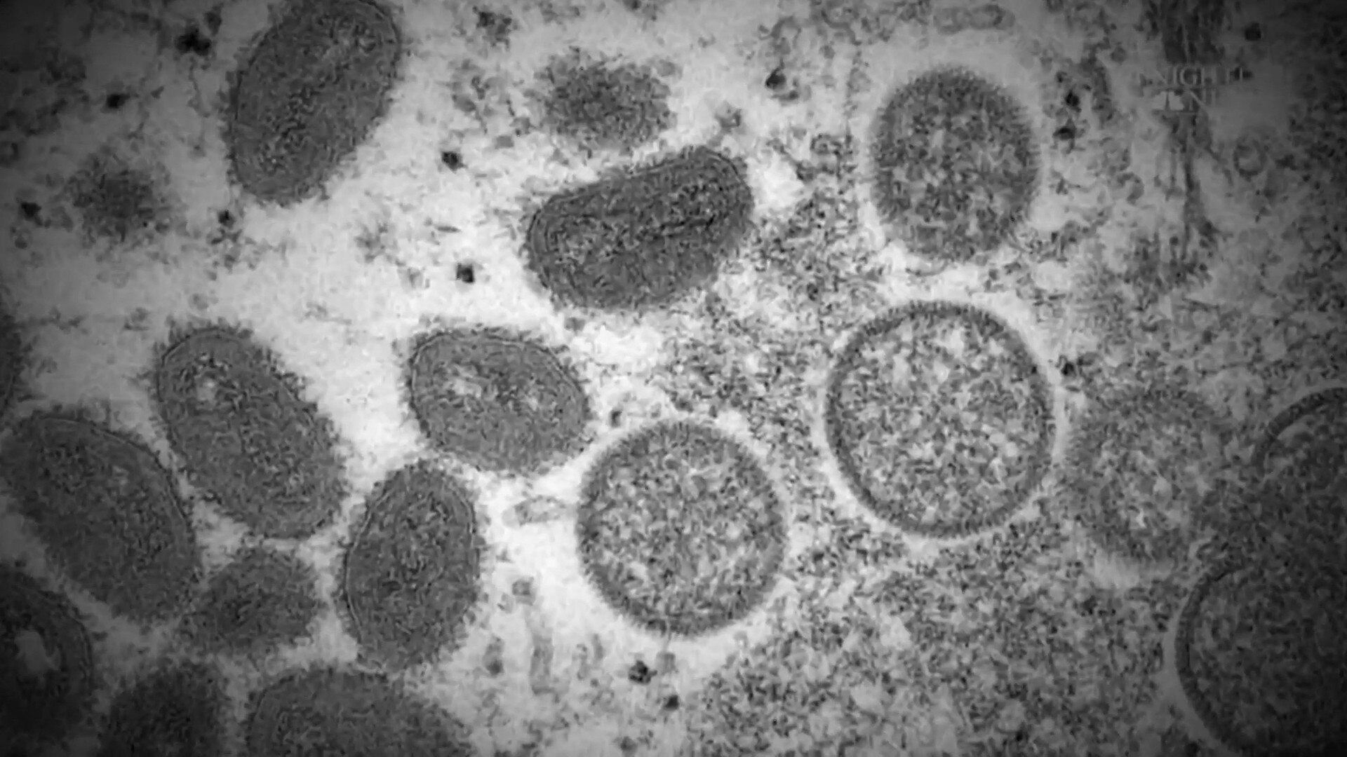 Watch TODAY Excerpt: Confusion over monkeypox mask guidance as cases ...