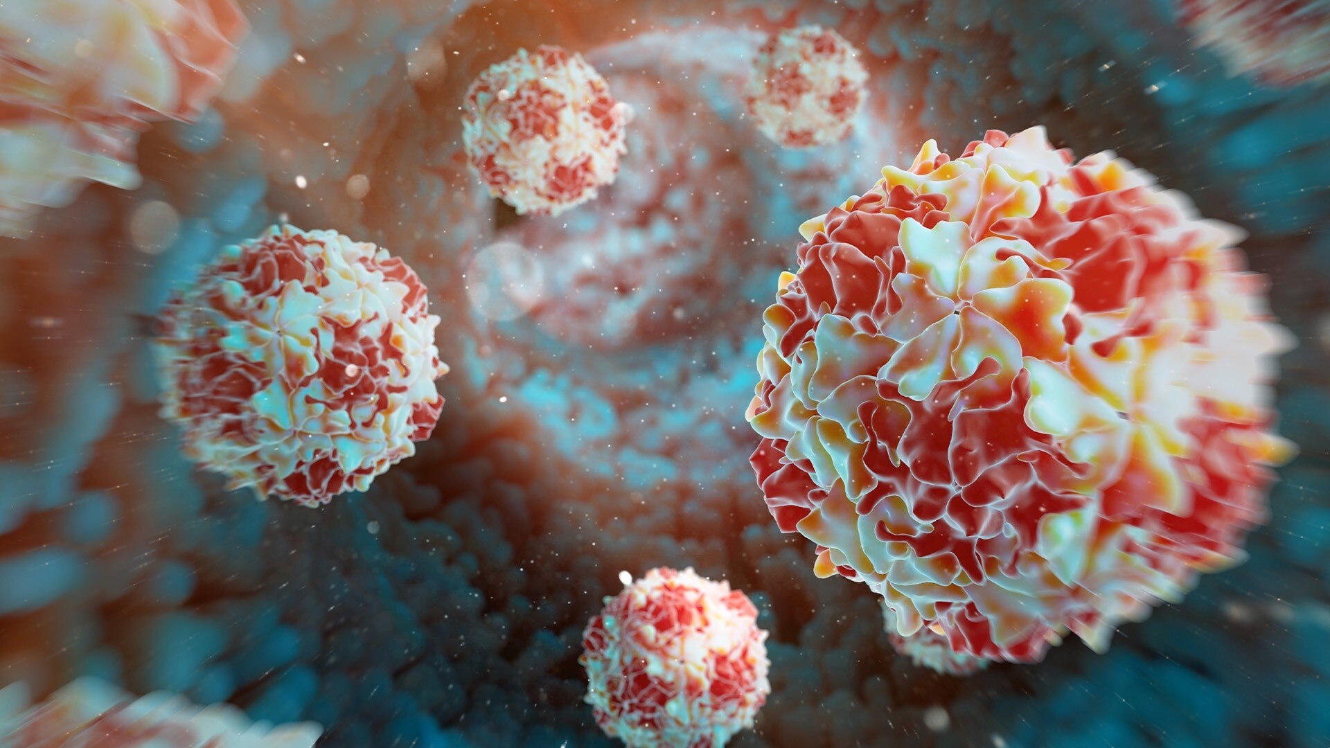 Watch Noticias Telemundo Mediodía Highlight: Lo que debe saber ante el ...