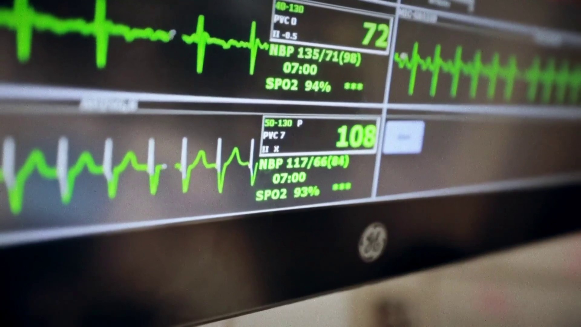 Watch TODAY Excerpt: New data appears to show link between COVID and ...