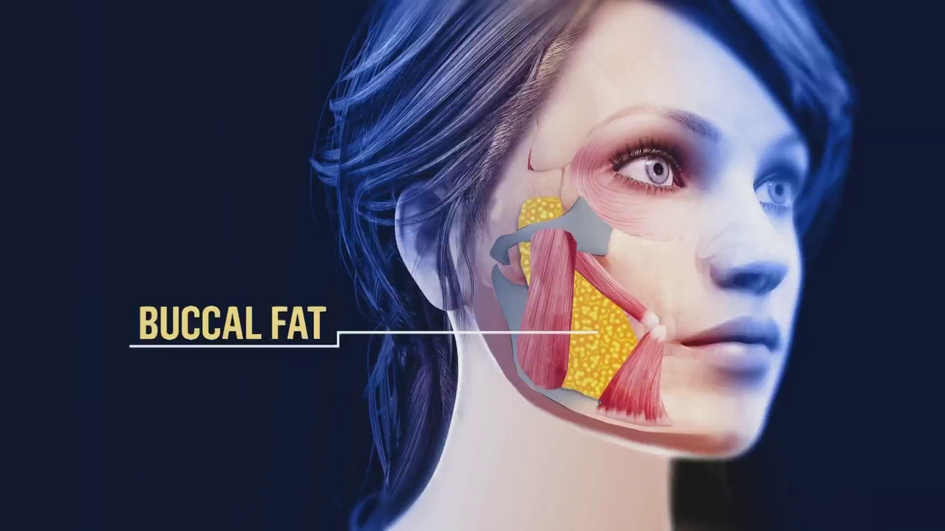 Watch TODAY Excerpt: Buccal fat removal: Inside latest trend to reshape ...