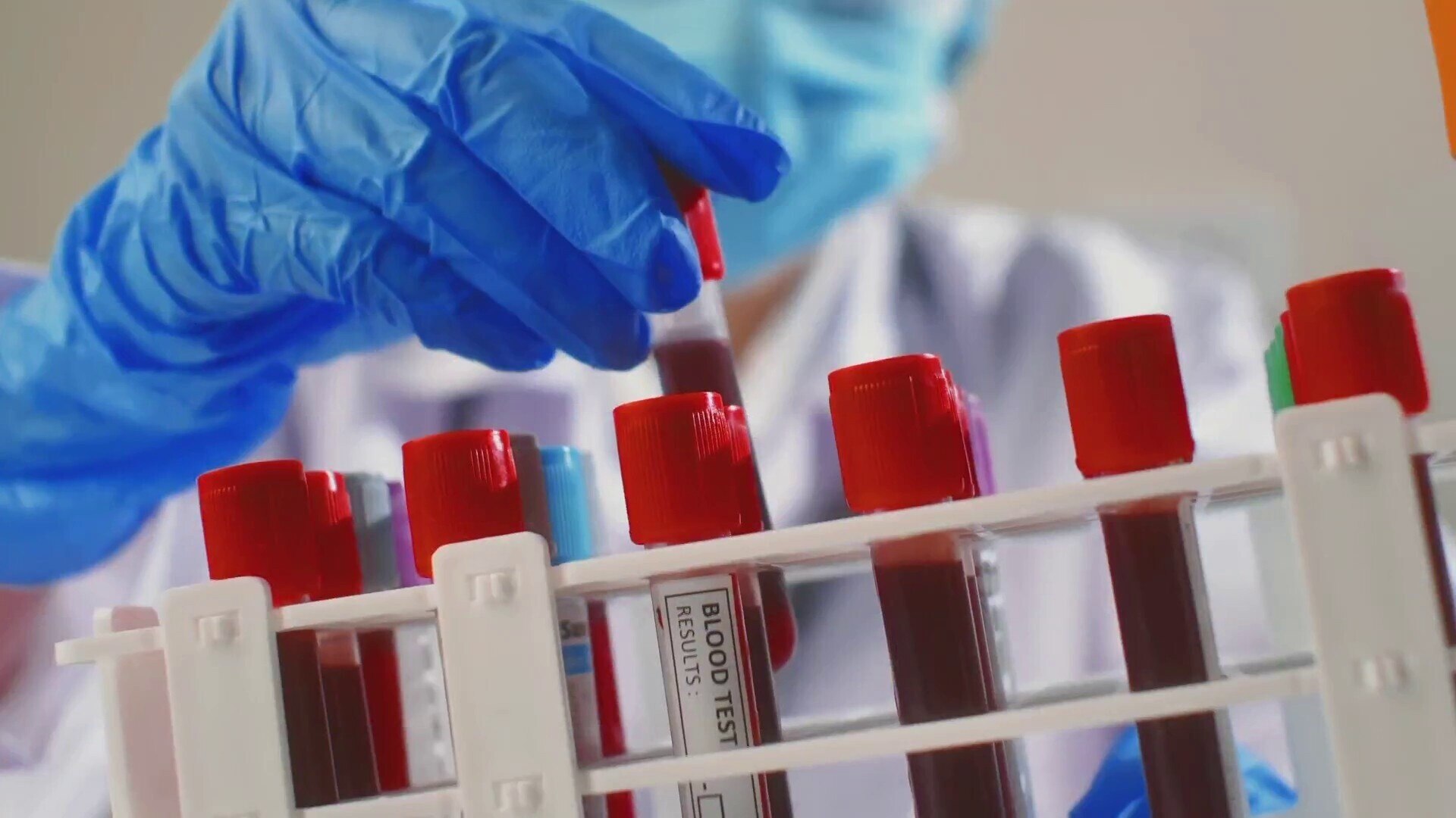 Watch TODAY Excerpt: What is a ‘liquid biopsy’ and how does it monitor colorectal cancer? - NBC.com